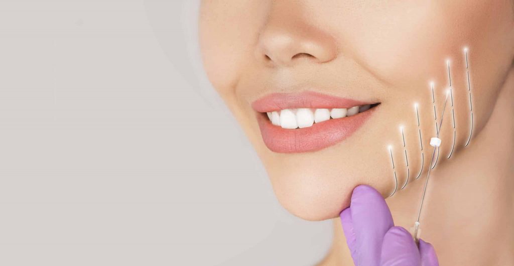 Faden­lifting - Doctor Abani